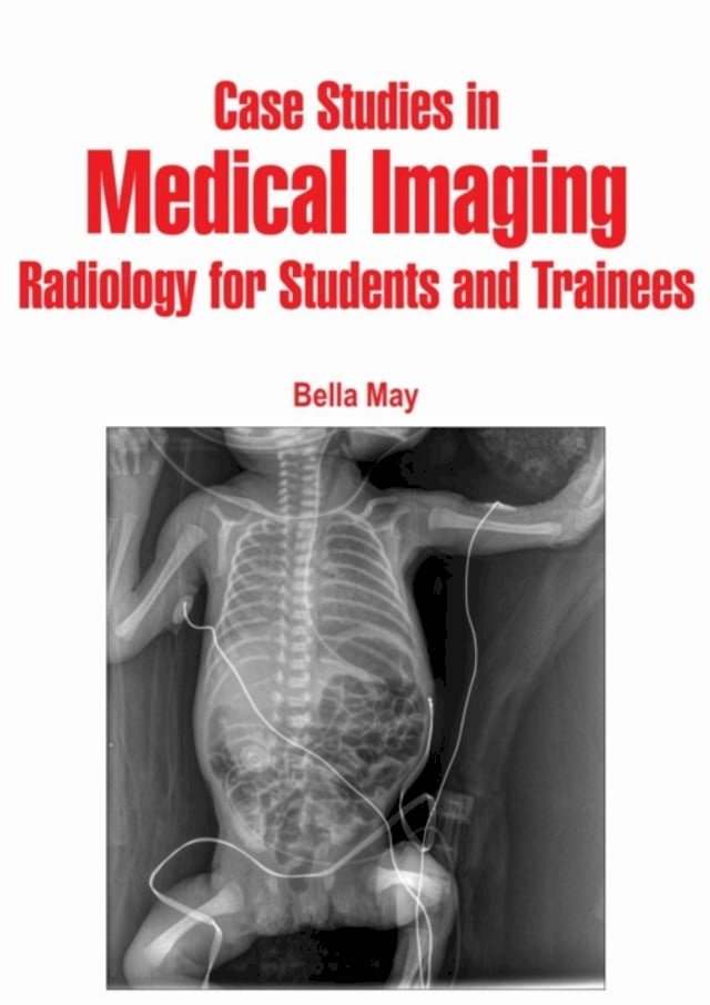 Case Studies in Medical Imaging - PChome 24h書店